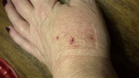 Why Does My Cat Bite Metal At Ester Gordan Blog