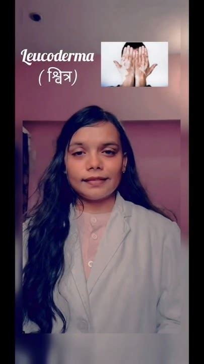 Leucoderma 🙌 It S Common Cause Youtube