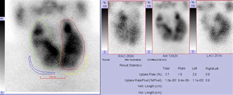 Tc 99m Nuclear Medicine Doctor Hospital Lhr Facebook