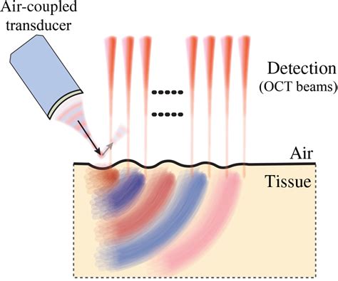 Optical Coherence Elastography In Ophthalmology
