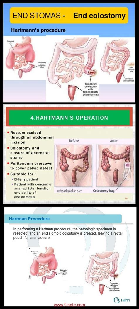 Pin On Surgery