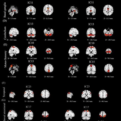 Two Sample Results Resting State Networks Between Control And Adhd Download Scientific Diagram