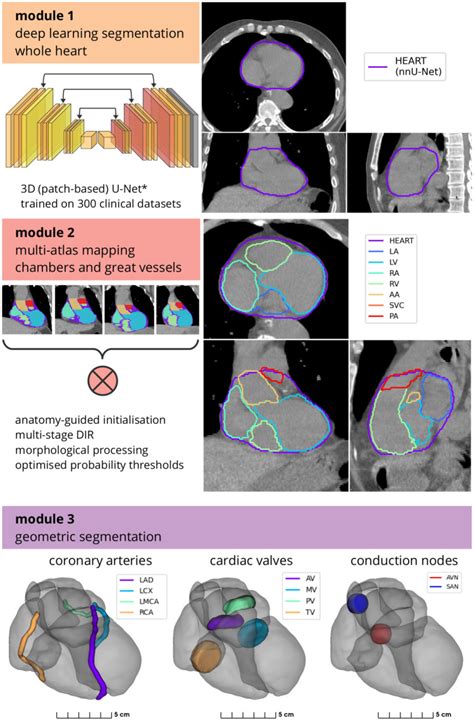 Open Source Fully Automated Hybrid Cardiac Substructure Segmentation Development And