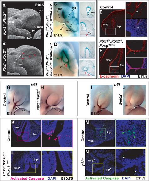 A Conserved Pbx Wnt P63 Irf6 Regulatory Module Controls Face Morphogenesis By Promoting