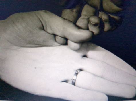 Msk Flashcards Quizlet