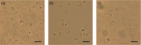 Microscope Observations During Differential Lysis Procedure A