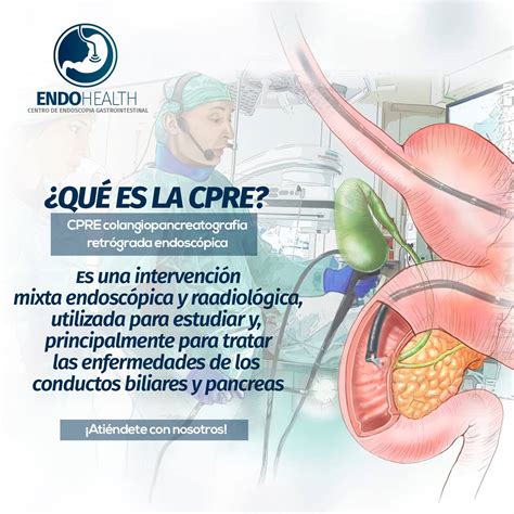 La Cpre Se Usa Cuando Se Sospecha Que Clínica Endohealth