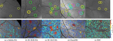 Retinal Microaneurysms Detection Using Local Convergence Index Features