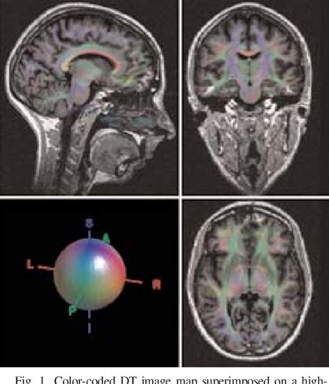 Figure 1 From A Primer On Diffusion Tensor Imaging Of Anatomical Substructures Semantic Scholar