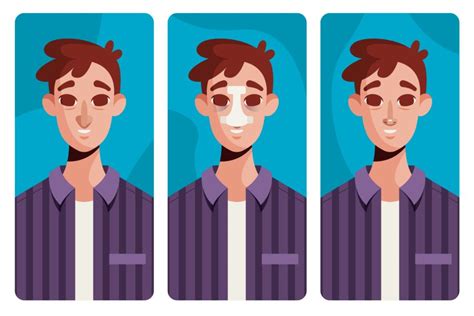 نحوه دریافت وام عمل بینی برای پرداخت هزینه جراحی بینی با پزشکان خوب