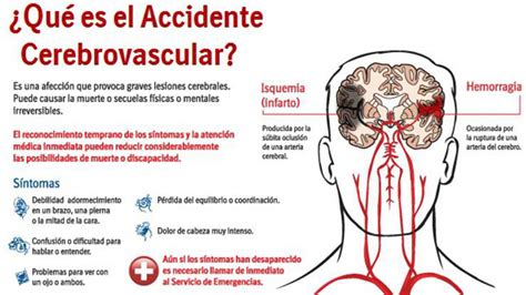 El Acv Es La Primera Causa De Incapacidad En El Mundo Infobae