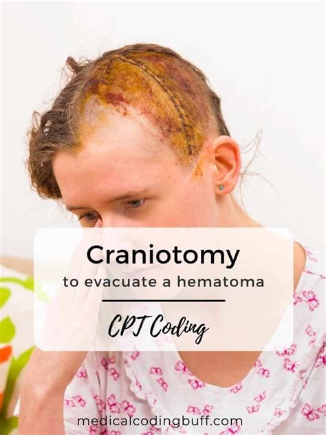 Craniotomy To Evacuate A Hematoma In Cpt Artofit