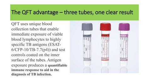 Tb Quantiferon Testpptx