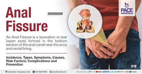 Fissure Definition Anatomy