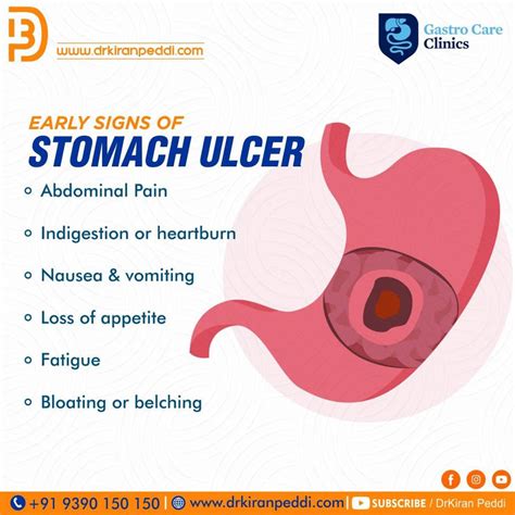 Stomach Ulcer Dr Kiran Peddi By Drkiranpeddiinfo On Deviantart