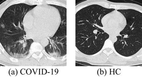 Ct Image From The Dataset Used Download Scientific Diagram