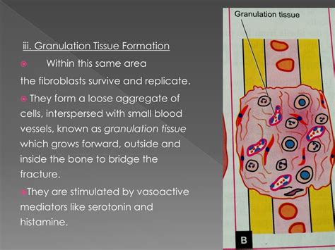 Ppt Bone Healing And Repair Seminar By Arifa Hassan Powerpoint