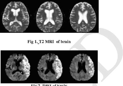 Figure 4 From An Integrated Method Of Mri Brain Image Segmentation
