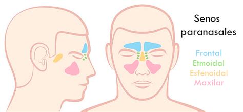 Sinusitis Maxilar ¿cuáles Son Sus Síntomas Y Tratamiento