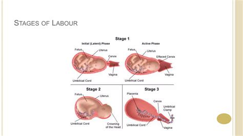 Stages Of Labour Pptx