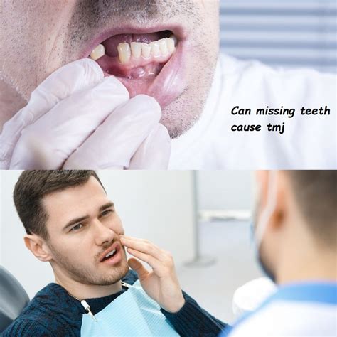 Can Missing Teeth Cause Tmj