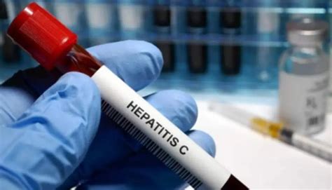 ¿cuántos Tipos De Hepatitis Hay Y Cuál Es La Más Peligrosa Esto Dice