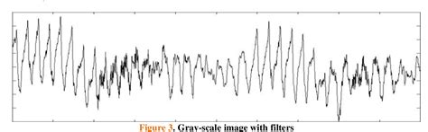 Figure 1 From Classification Of Arrhythmia Diseases By The Convolutional Neural Network Method