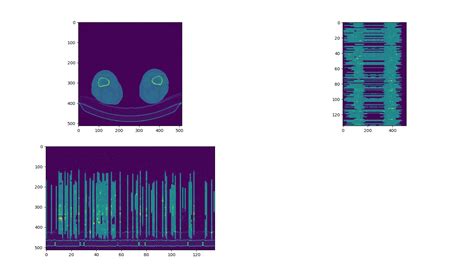 Slice Dicom Slicing Orders In Python Stack Overflow