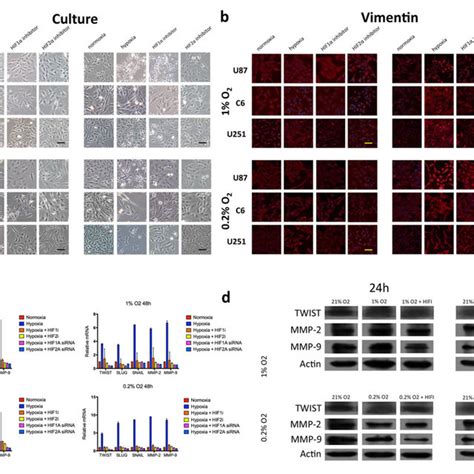Microfluidic Chip Migration Assay Of U87 Glioblastoma Cells A Download Scientific Diagram