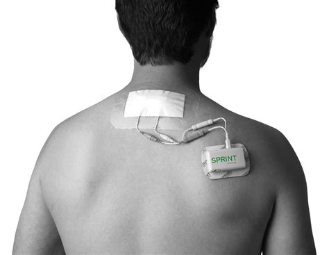 SPRINT PNS System Brings Breakthrough Pain Relief