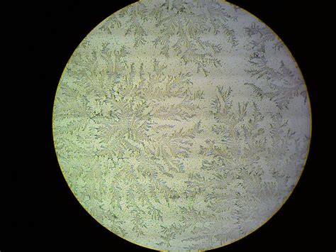Amniotic Fluid Membrane Patterns In Nature