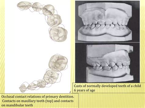 Occlusion Pptx