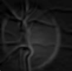 Image How To Segment Blood Vessels Python Opencv Stack Overflow