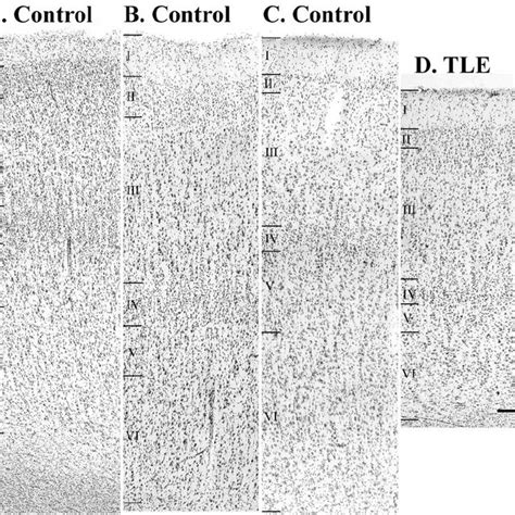 Photomicrographs Of Layers I Vi Of Temporal Neocortex In Controls Ac Download Scientific