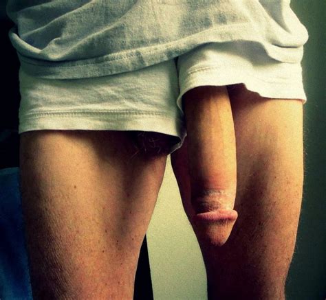 Penis Transplant Lpsg