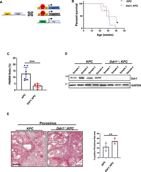 Discoidin Domain Receptor 1 Ddr1 Is Necessary For Tissue Homeostasis