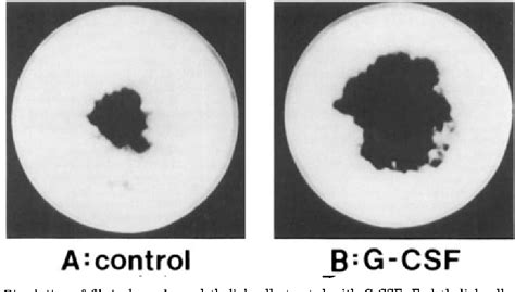 Figure 4 From Granulocyte Colony Stimulating Factor Semantic Scholar