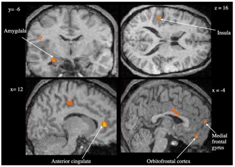 the neural correlates of emotional memory retrieval emotion brain