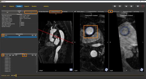 4 Common Workflows — Gtflow 48x Documentation