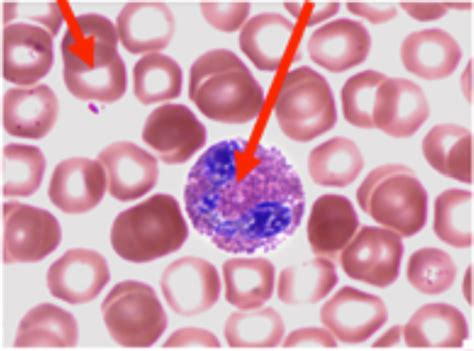 Week 8 Lc Questions Flashcards Quizlet