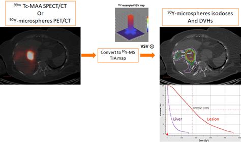 Voxel Based Dosimetry Process Illustrating How 99m Tc Maa Spect Ct And