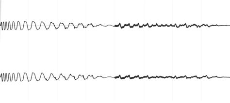LINEAR PHASE EQUALISATION EXPLAINED RJMEANEY AUDIO