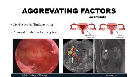 Subinvolution Youtube