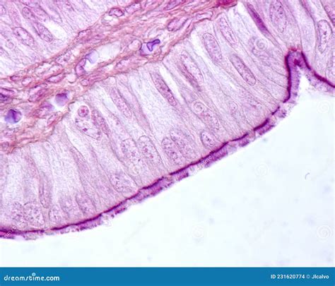 Simple Columnar Ciliated Epithelium