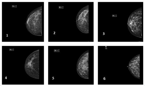 Bi Rads Categorization Download Scientific Diagram