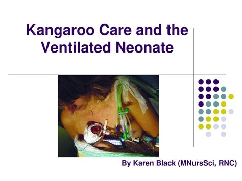 Kangaroo Care And The Ventilated Neonate Ppt Download