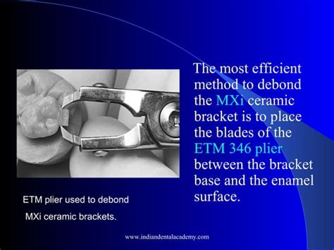 Debonding Techniques And Enamel Fracture Patterns Certified Fixed Orthodontic Courses By Indian