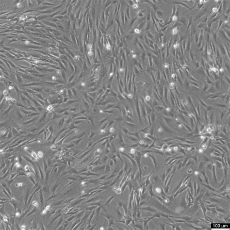 Bj Fibroblast Cells