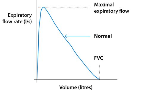 Spirometry And Reversibility Testing Asthma Lung Uk