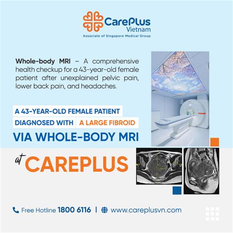 Customer Story 43 Year Old Woman Discovers Large Fibroid Through Whole